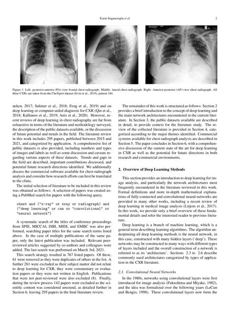 Deep Learning For Chest X Ray Analysis A Survey Deepai