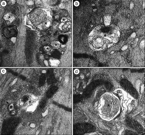 Autophagic Vacuoles Are Prominent In Runx1 Mutant Denervated Myofibers