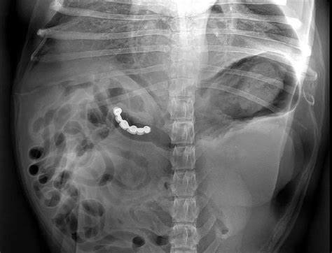 31 Funny X Ray Images That Seem Too Ridiculous To Be Real