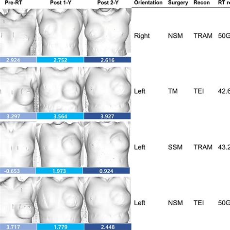 Linear Mixed Model Predicting Anomaly Score Download Scientific Diagram