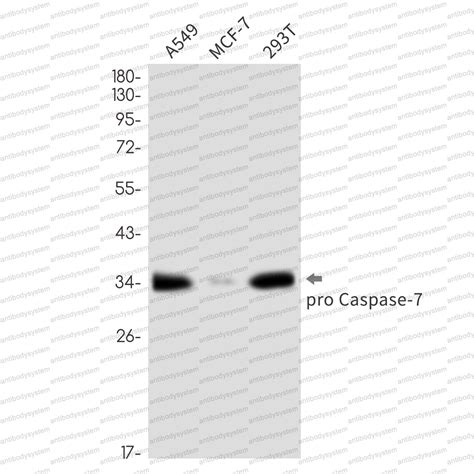 Anti Casp7 Antibody R1z24antibodysystem