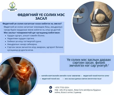 Ulaanbaatar 🦵 Өвдөгний үе солих хагалгаа нь үеийн элэгдэл гэмтэл ихэсч бусад эмчилгээ үр