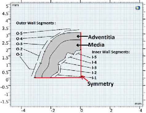 Figure 1 From Comparison Of A Histology Based Multi Layer Artery Model