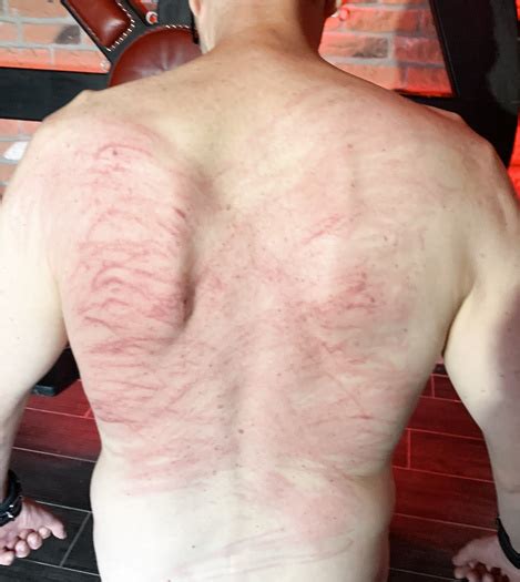 Pain Image Thisvid Tube