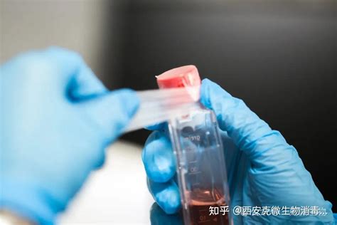 如何解决细胞培养实验室霉菌污染？ 知乎