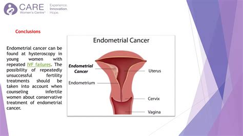 Endometrial Cancer In A Woman Undergoing Hysteroscopy For Recurrent Ivf