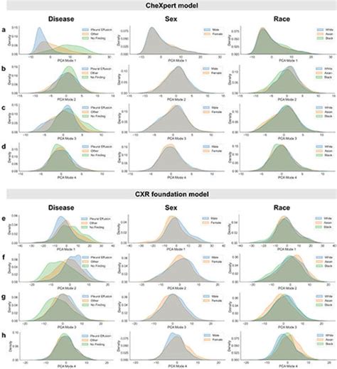 Ai Model For Chest X Ray Demonstrates Race Sex Bias Applied Radiology