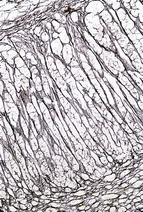 Human Adrenal Gland Cortex 2 By Science Photo Library