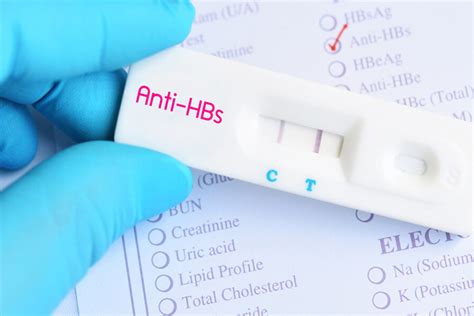 Anti Hbs Nova Fertil