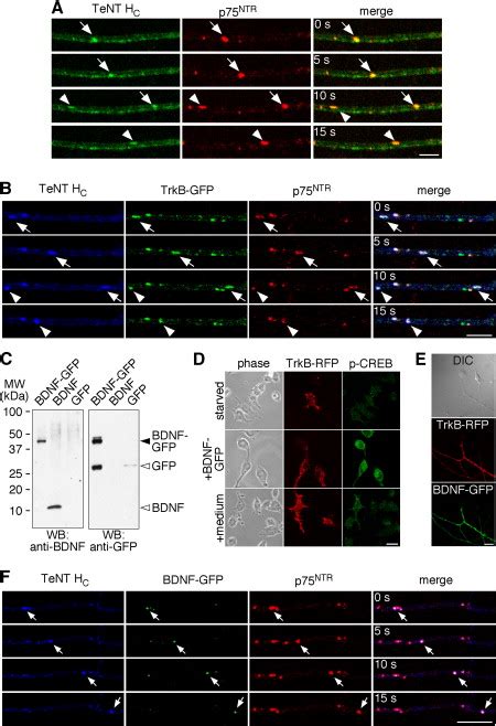 Rab5 And Rab7 Control Endocytic Sorting Along The Axonal Retrograde