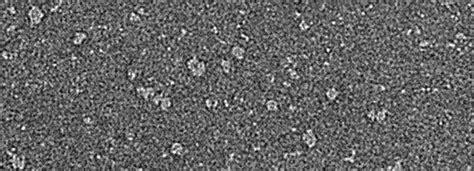 Protein Staining Methods An Overview Of 3 Of The Best Bitesize Bio