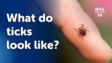 Tick Bite Pictures Symptoms What Does A Tick Bite Look Like Lupon Gov Ph