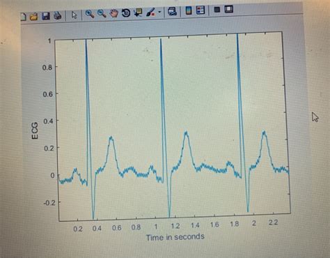 Matlab Program Ecgplotm Use This Program To Read