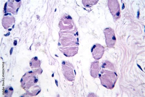 skeletal muscle atrophy photomicrograph showing decreased fiber size
