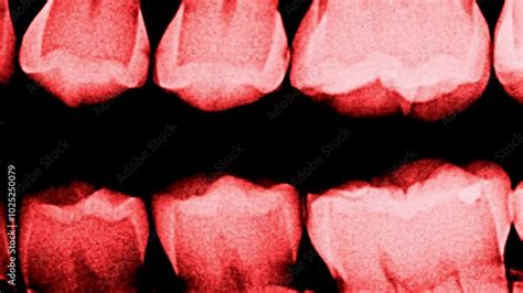 Stop Motion Of Human Teeth X Ray Or Ct Scan Horror Collection Human