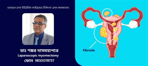 Best Uterine Fibroids Treatment In India Drsankar Dasmahapatra Gynaecologist