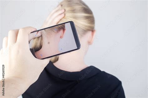 The Woman Shows His Neck With A Chip Implanted Which Is Read Or Scanned