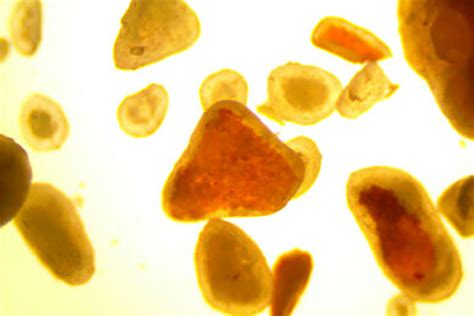 Using Microencapsulation To Improve Gut Health And Feed Efficiency Vietnam Livestock Magazine