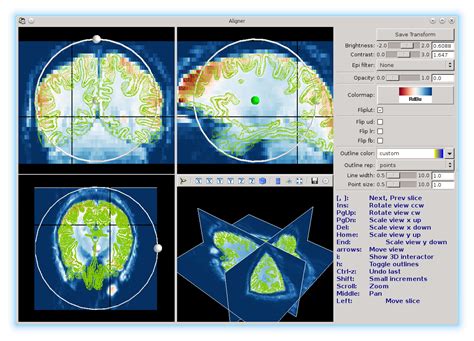 Alignments Pycortex Documentation
