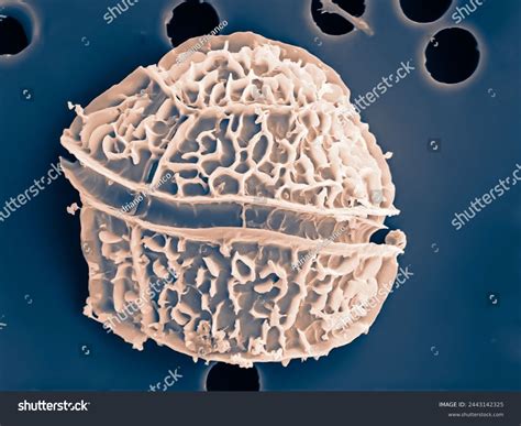 Dinoflagellate Algae Photographed Electron Microscope On Stock Photo Shutterstock