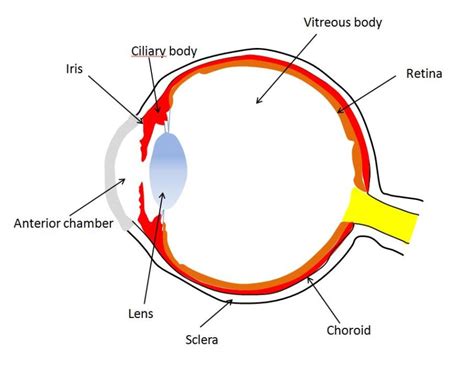 Uveitis Anterior