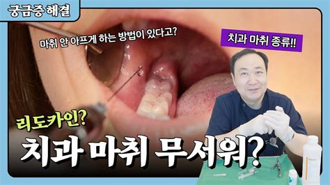 치과 마취 종류와 치과 마취 안 아프게 하는 방법 Youtube
