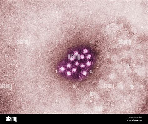 An Electron Micrograph Of The Hepatitis A Virus Hav An Rna Virus That Can Survive Up To A