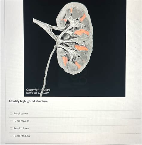 Solved Identify Highlighted Structureqrenal Cortexrenal