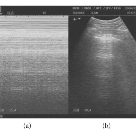 M Mode A And B Mode B A Line Ultrasound Images Download Scientific Diagram