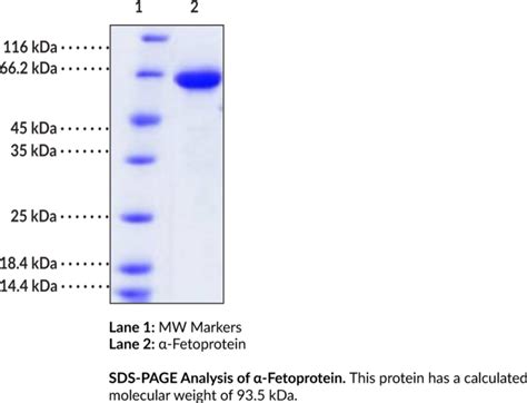 α Fetoprotein Human Recombinant