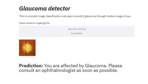 Github Golden Pantherglaucoma Detector Glaucoma Detection