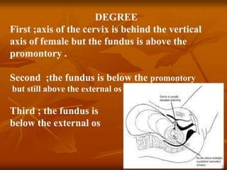 Displacement Of The Uterus Pptx
