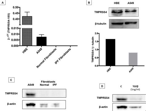 Transmembrane Protease Serine 4 Tmprss4 Is Upregulated In Ipf Lungs