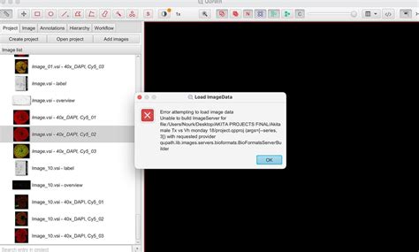 Cant Open A Project On Qupath Image Analysis Imagesc Forum