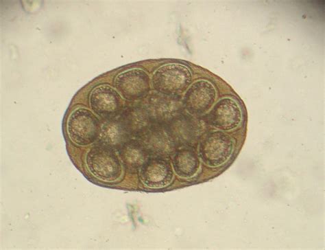 Dipylidium Caninum Slide Labeled