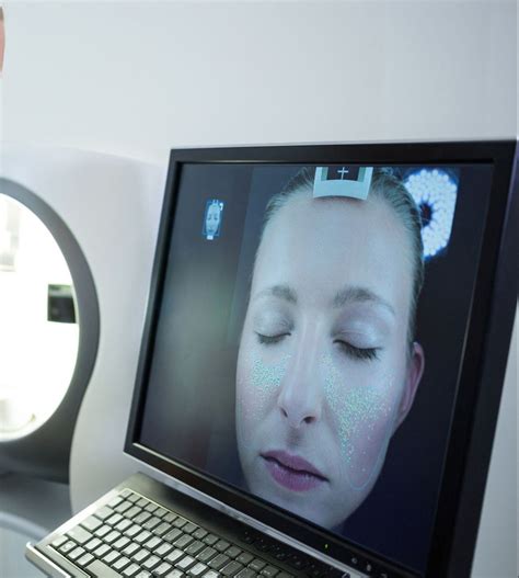 Visia Complexion Analysis Ottawa On Faces Dermamedical
