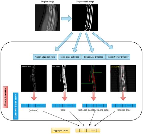 The Steps Of Feature Extraction Download Scientific Diagram