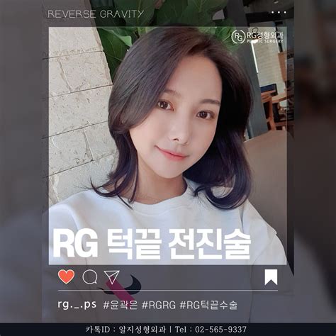 Rg 알지성형외과 Rg만의 무턱교정술 Rg성형외과 남들과는 다른이유 Rg성형외과 간편하게