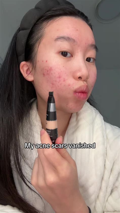 Comparativa De Correctores Nars Vs Bye Bye Under Eye Tiktok