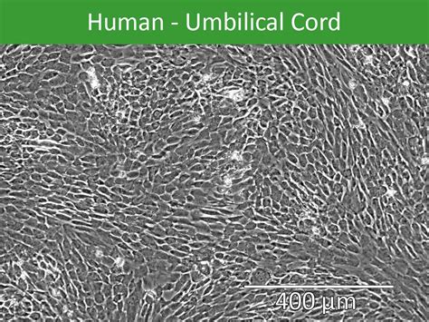 Human Umbilical Cord Derived Mesenchymal Stem Cells Female • Jangocell