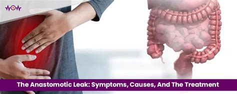 The Anastomotic Leak Symptoms Causes And The Treatment