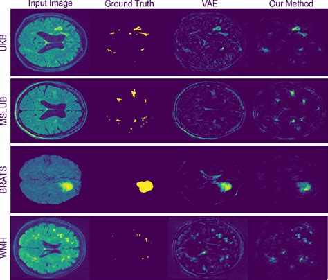 Unsupervised Brain Anomaly Detection And Segmentation With Transformers