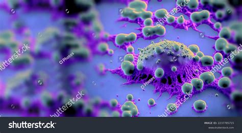 5 577 Tumor Cell Research 이미지 스톡 사진 및 벡터 Shutterstock