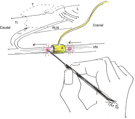 Representation Of Left Vagus Nerve Stimulation Proximal And Distal To Download Scientific