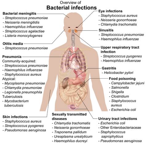 Difference Between Fungal And Bacterial Infection Cause Common Types