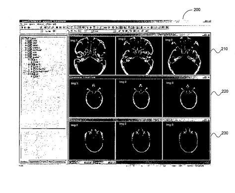 Point Set Registration Patented Technology Retrieval Search Results Eureka Patsnap