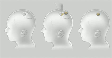 Elon Musk Wants YOU To Build A Brain Computer Interface Electronic Products