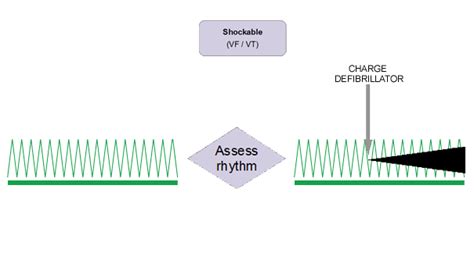 Resuscitation Council UK Advanced Life Support Using The ALS Treatment Algorithm