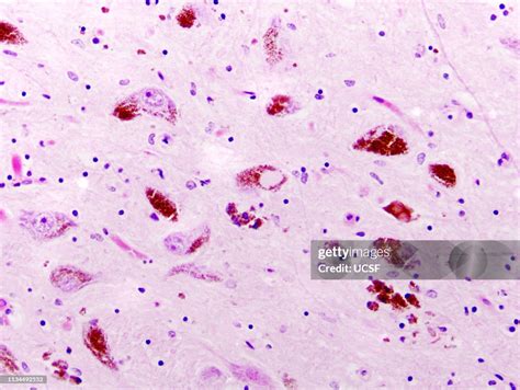 Substantia Nigra Histology