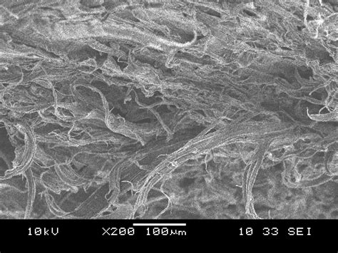 SEM Micrograph Of Tensile Fracture Surface Of A RHDPE EVA ESP B Download Scientific